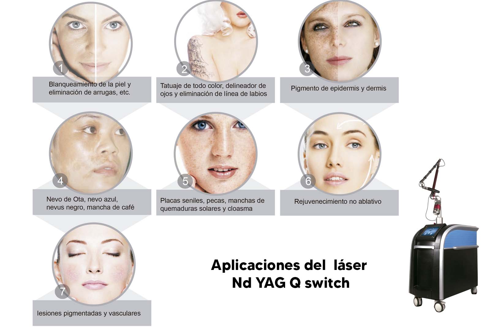 Láser Nd YAG Q switch – Clínica de medicina estética y dental